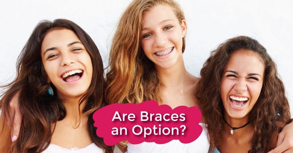 Do You Need Braces on Both Arches When Straightening Teeth? | Aesthetic ...